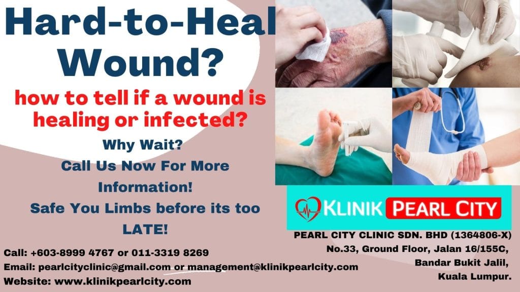Hard-to-Heal Wounds | Klinik Pearl City | Bukit Jalil, Kuala Lumpur